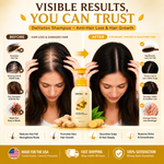 Deliiston Anti-Hair Loss Shampoo