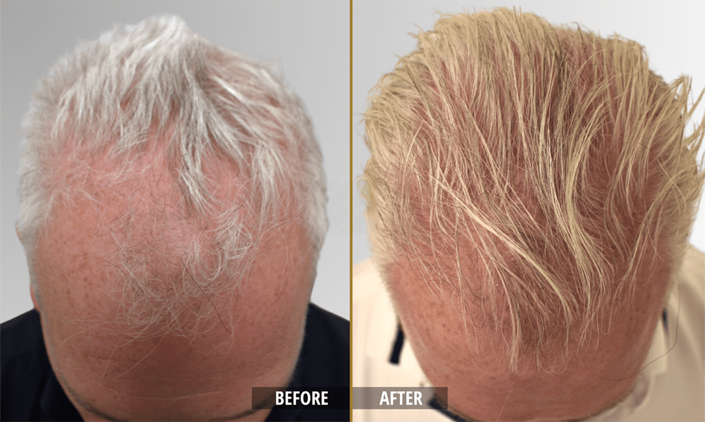 Deliiston Anti-Hair Loss Shampoo