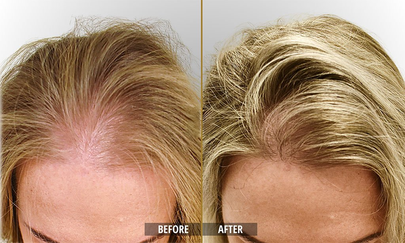 Deliiston Anti-Hair Loss Shampoo